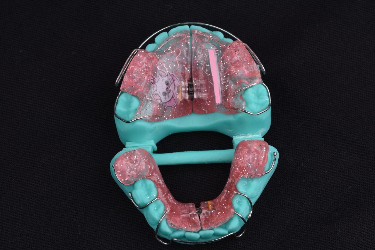 Twin Block - Digital Lab Institute | Laboratório de Odontologia Digital