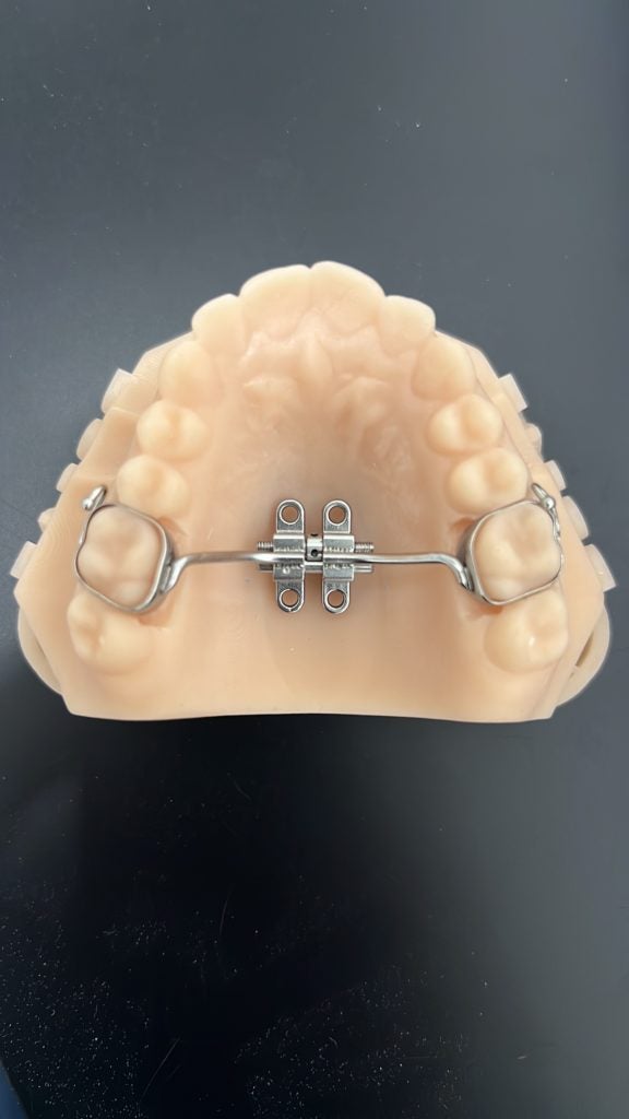 Marpe 4 dats (MORELLI) - Digital Lab Institute | Laboratório de ...